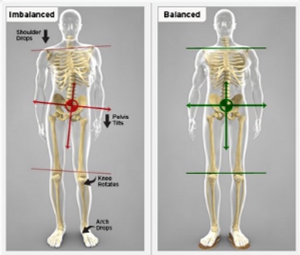 Correcting Posture and Body Alignment: An Effective Solution for ...
